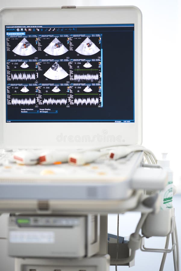 Modern ultrasound machine stock photo. Image of doctor - 72662450