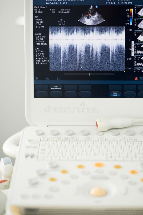 Modern ultrasound machine stock image. Image of doppler - 72663675