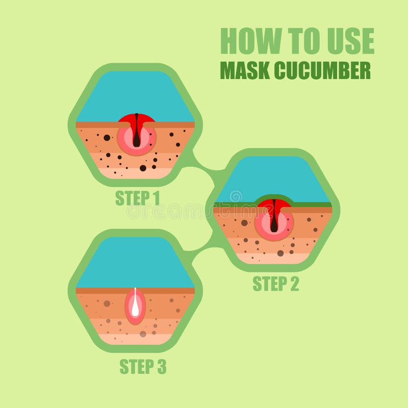 Modern Vector Illustration of Skin Problems. Dark Dots, Acne Stock ...