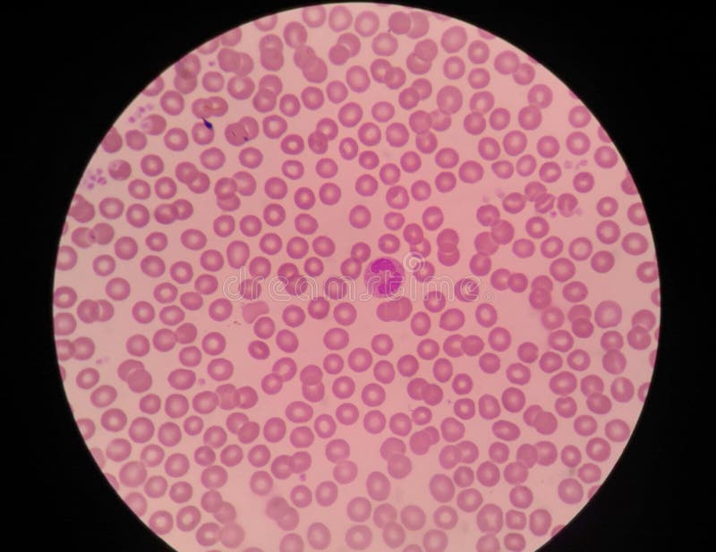 Red Blood Cells Medical Science Background. Stock Photo - Image of ...