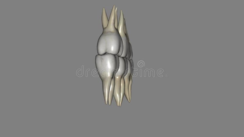 Maxillary and Mandibular Prosthesis with Gum All on 4 System Supported ...