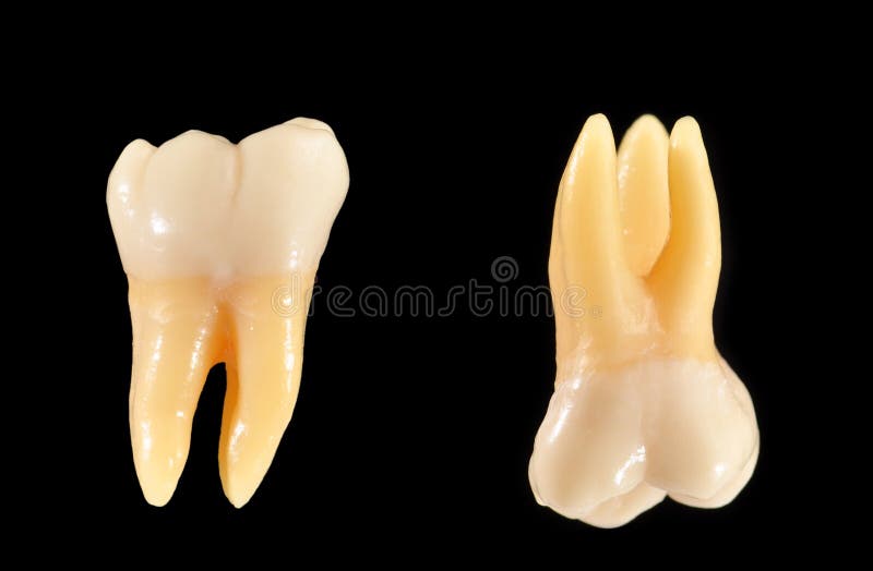 Molar Teeth Isolated on Black Stock Image - Image of crown, anatomic ...