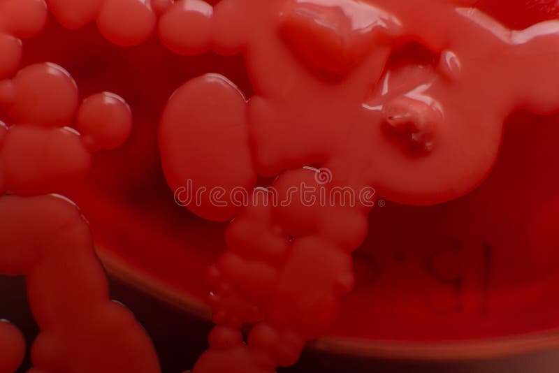 Mold and Bacteria on Red Agar. Agar Medium for Pathogens. Mold Spores ...