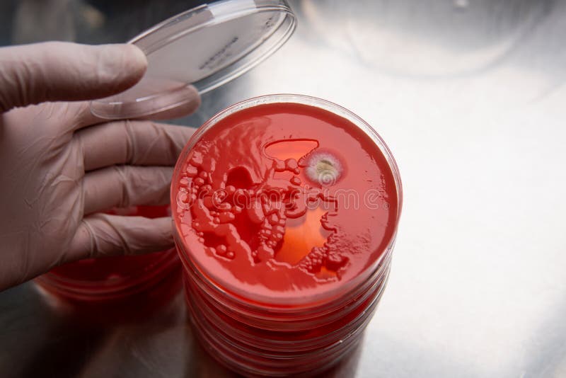Mold and Bacteria on Red Agar. Agar Medium for Pathogens. Mold Spores ...