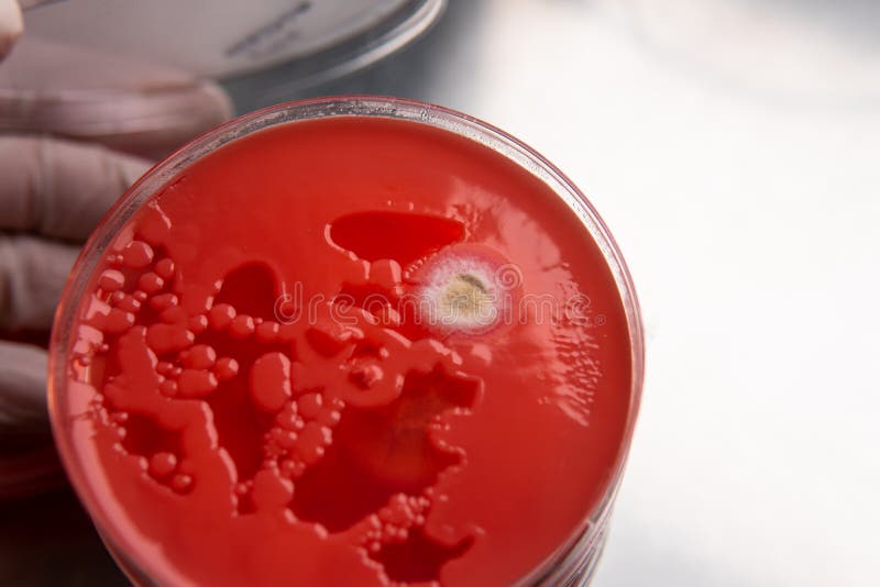 Mold and Bacteria on Red Agar. Agar Medium for Pathogens. Mold Spores ...