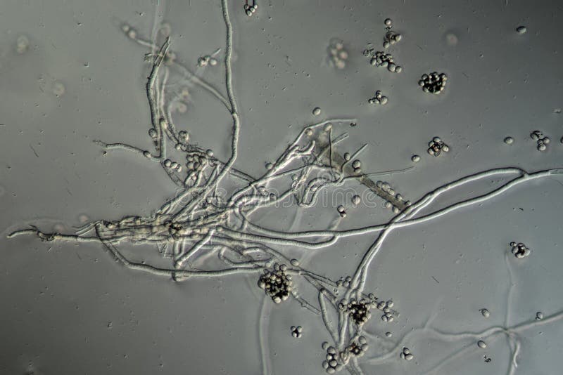 Mold filaments and spores stock photo. Image of fungi - 248210482
