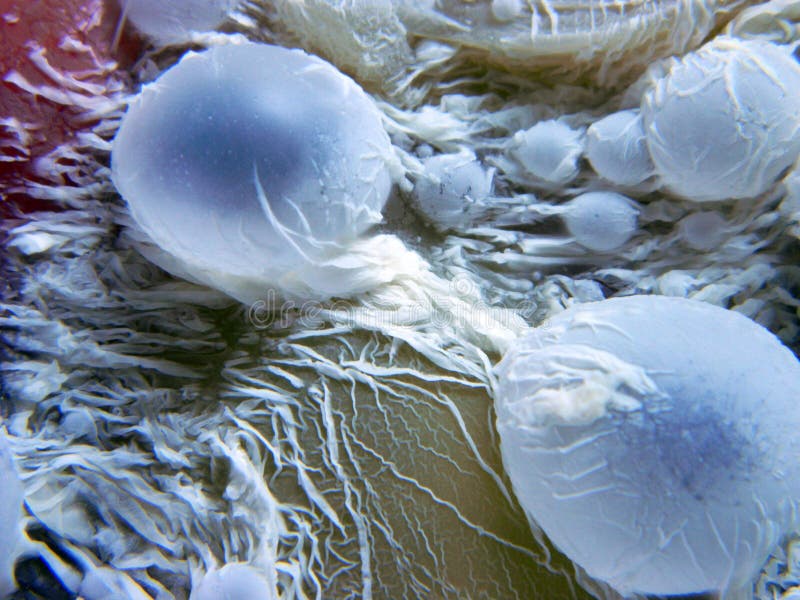 Mold Isolated on Black Background Stock Image - Image of delicious ...