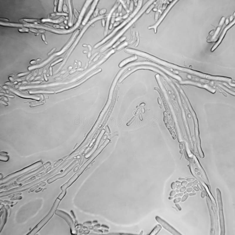 Mold at the microscope stock image. Image of mold, background - 111147609