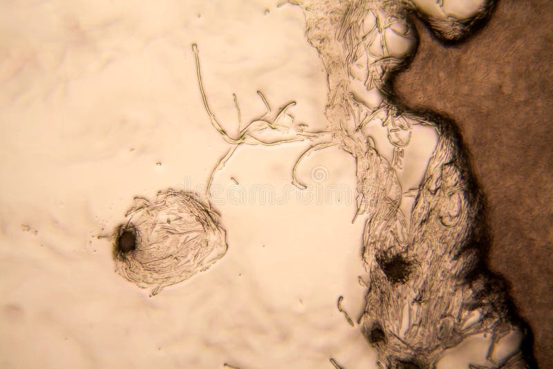 Mold at the microscope stock image. Image of microorganisms - 111147619