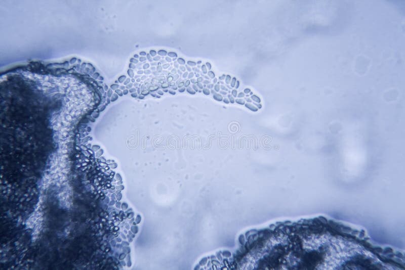 Mold at the microscope stock photo. Image of health - 111147124