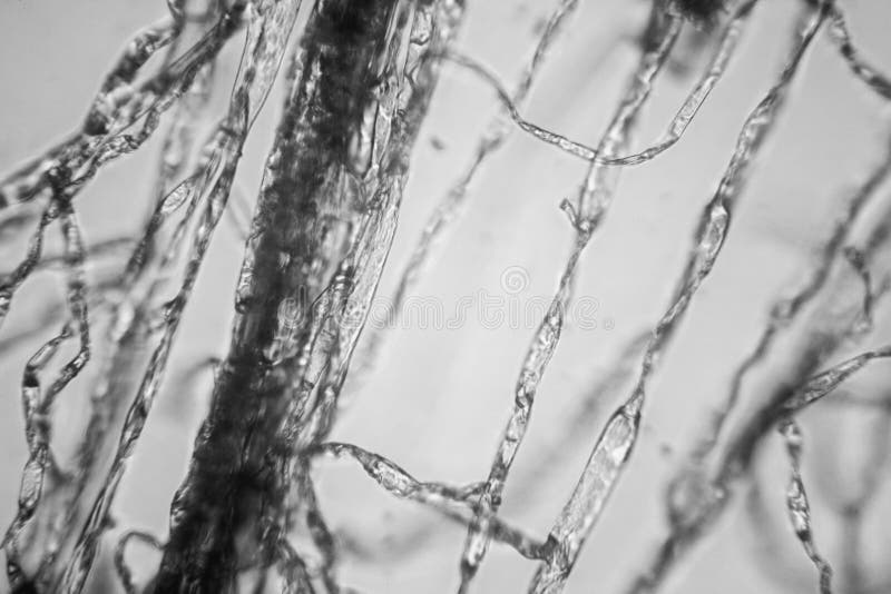 Mold at the microscope stock photo. Image of hygiene - 111147786