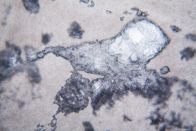 Mold at the microscope stock image. Image of microorganisms - 111147619