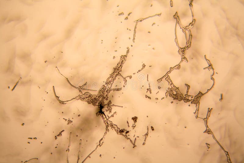 Mold at the microscope stock photo. Image of closeup - 111147620