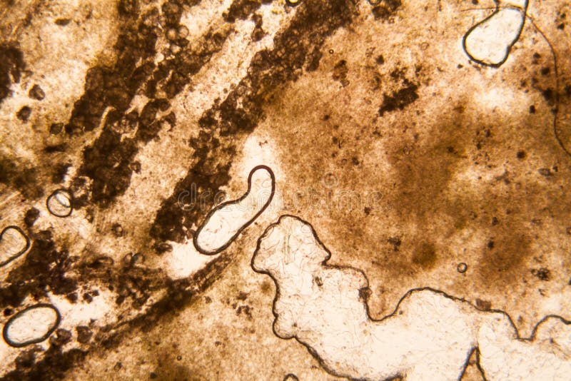 Mold at the microscope stock photo. Image of dish, hygiene - 111147470