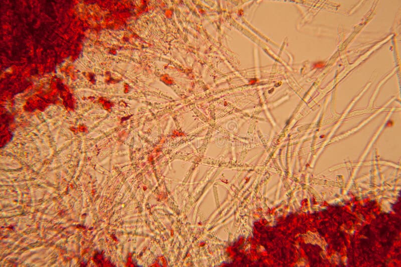 Mold at the microscope stock photo. Image of abstract - 111147222