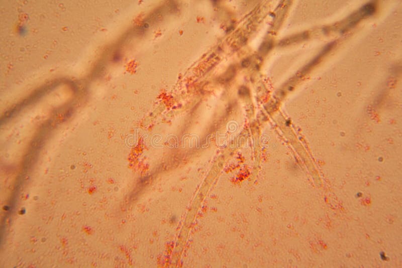 Mold at the microscope stock photo. Image of fungal - 111147244