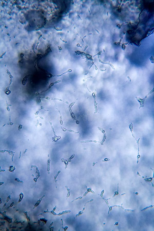 Mold at the microscope stock image. Image of details - 111147231