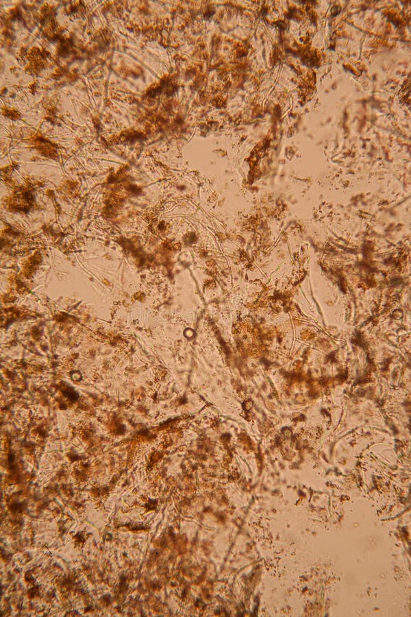 Mold at the microscope stock photo. Image of medicine - 111147134