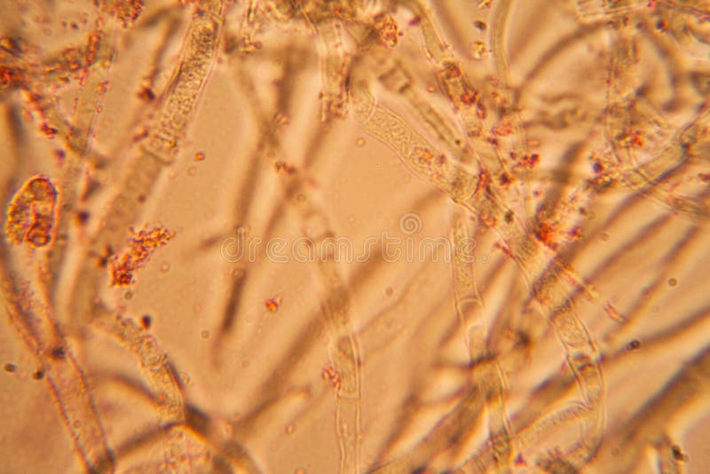 Mold at the microscope stock image. Image of mold, life - 111147221