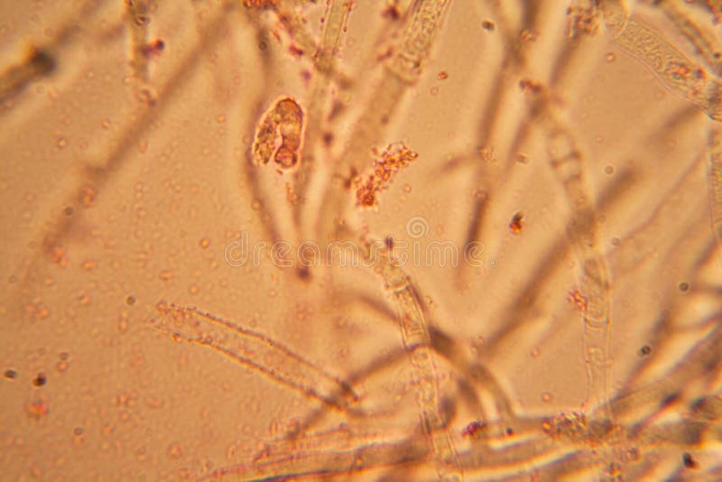 Mold at the microscope stock image. Image of details - 111147231
