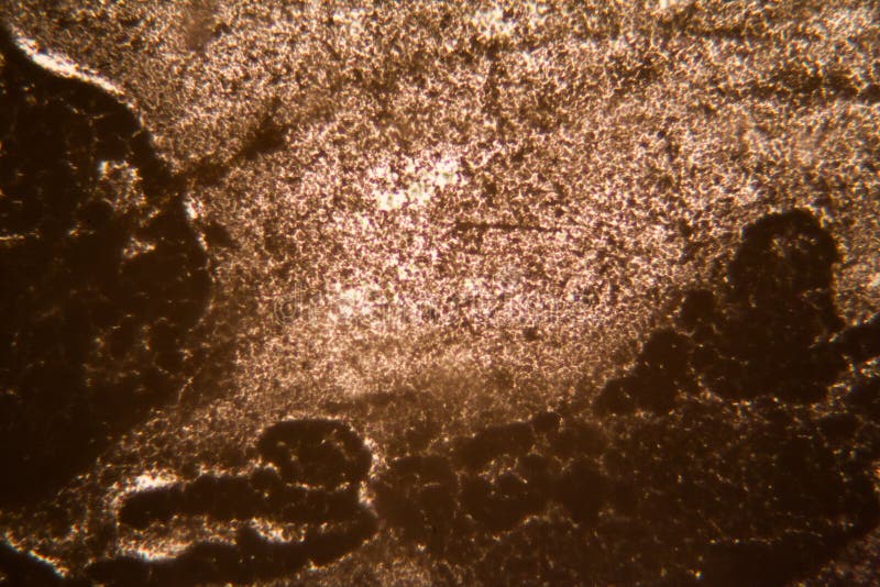 Mold at the microscope stock photo. Image of macro, fungus - 111147290