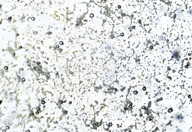 Mold Spores Under the Light Microscope, Orange Peel Mold Stock Photo ...