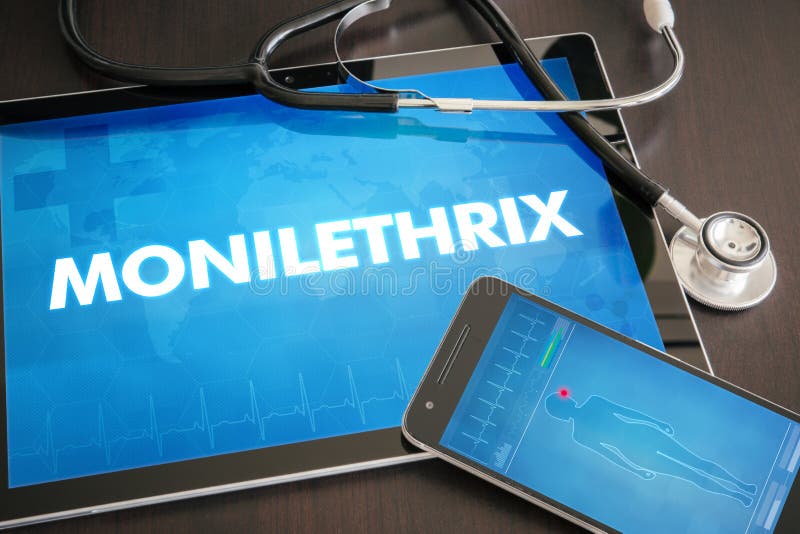 Monilethrix Stock Photos - Free & Royalty-Free Stock Photos from Dreamstime