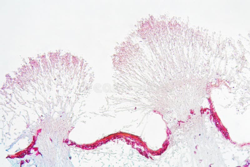 Monilinia Fructigena Under the Microscope Stock Image - Image of ...