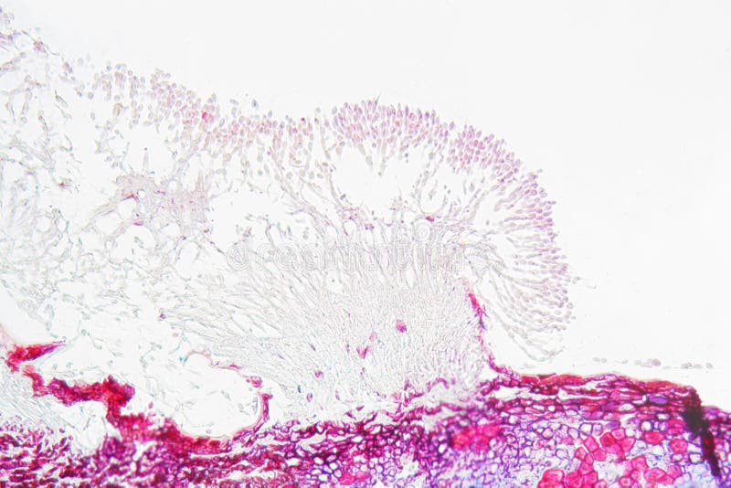 Monilinia Fructigena Under the Microscope Stock Photo - Image of ...