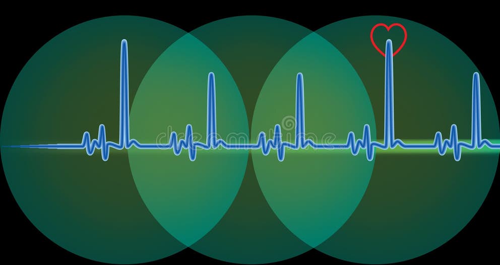Blue Heart Monitor Stock Illustrations – 6,212 Blue Heart Monitor Stock ...
