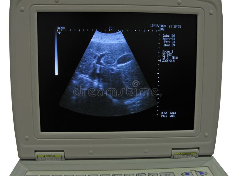 Monitor Cardiovascular Del Color, Diagrama Cardiio Imagen de archivo ...