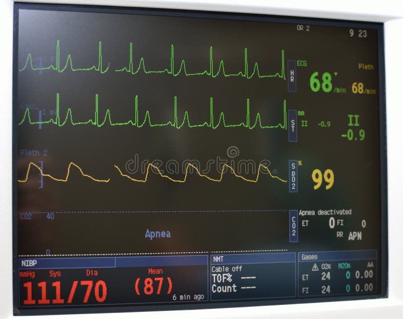 Pediatric ICU with ECG Monitor Stock Image - Image of hospital ...