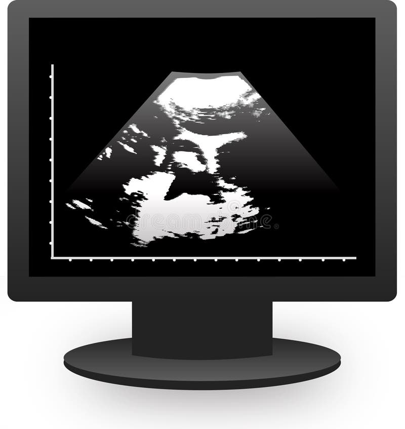 Medical Monitor Scan Stock Illustrations – 2,360 Medical Monitor Scan ...
