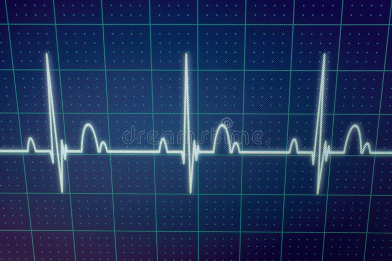 Monitor Elettrocardiogramma/di ECG Immagine Stock - Immagine di cuore ...
