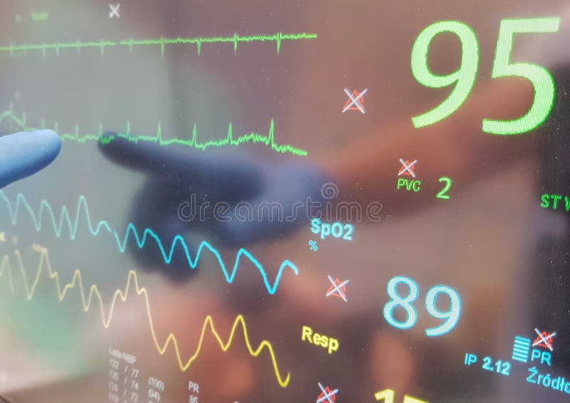 Life functions monitor stock image. Image of monitor, doctor - 3298629