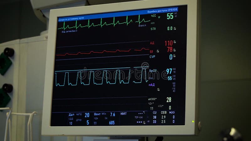 The Monitor in the Operating Room Stock Video - Video of device ...