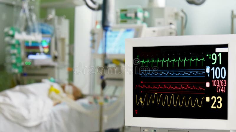 Monitor with Patient stock footage. Video of surveillance - 55704328