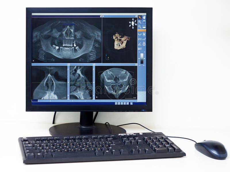 Monitor a X-ray Computer Setup in a Dental Clinic Lab Stock Image ...