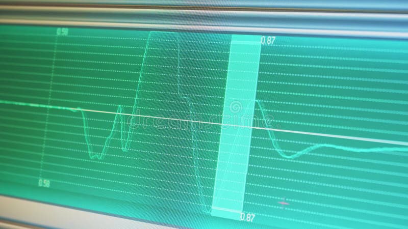 Monitor Screen with the Image of High-frequency Waves. Analysis and ...