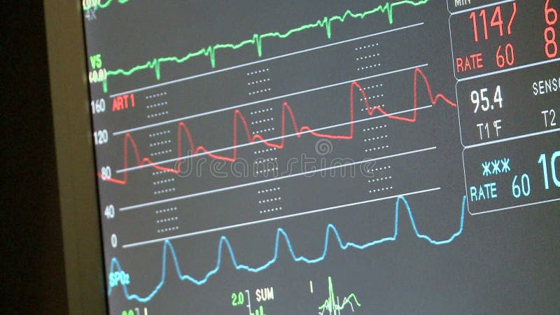 Vital Signs Monitor Display. Digital Vital Signs Monitor Displaying ECG ...