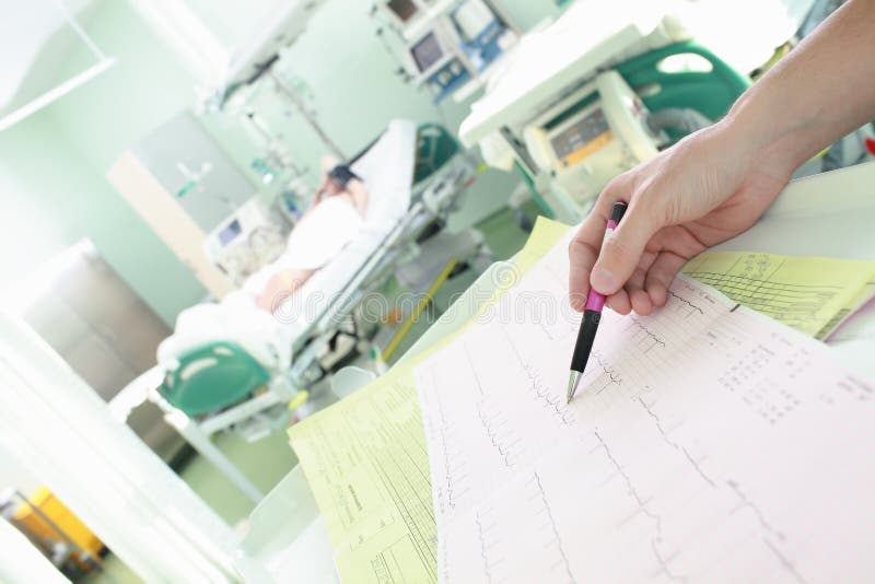 Monitoring ECG in the ICU stock photo. Image of research - 54252698