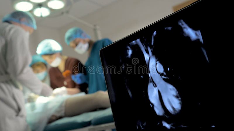 Monitoring of ECG and Saturation O2 in the Patient in the Operating ...