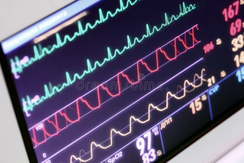 Monitoring of the Patient in the ICU Stock Photo - Image of equipment ...