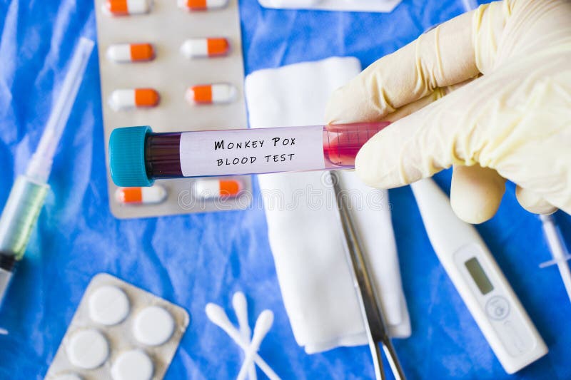 Monkey Pox virus stock image. Image of virus, patient - 331463631