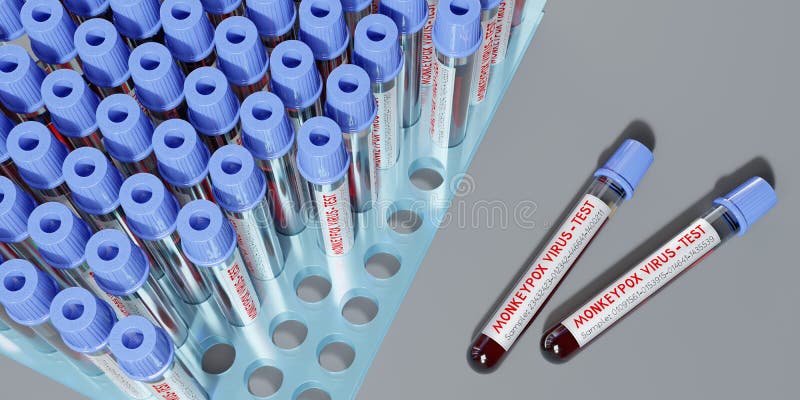 Monkeypox Test Stock Illustrations – 254 Monkeypox Test Stock ...