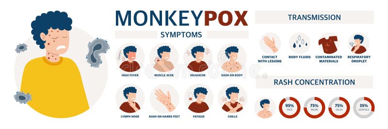Monkey Pox Virus Poster To Inform about the Pandemic and the Spread of ...
