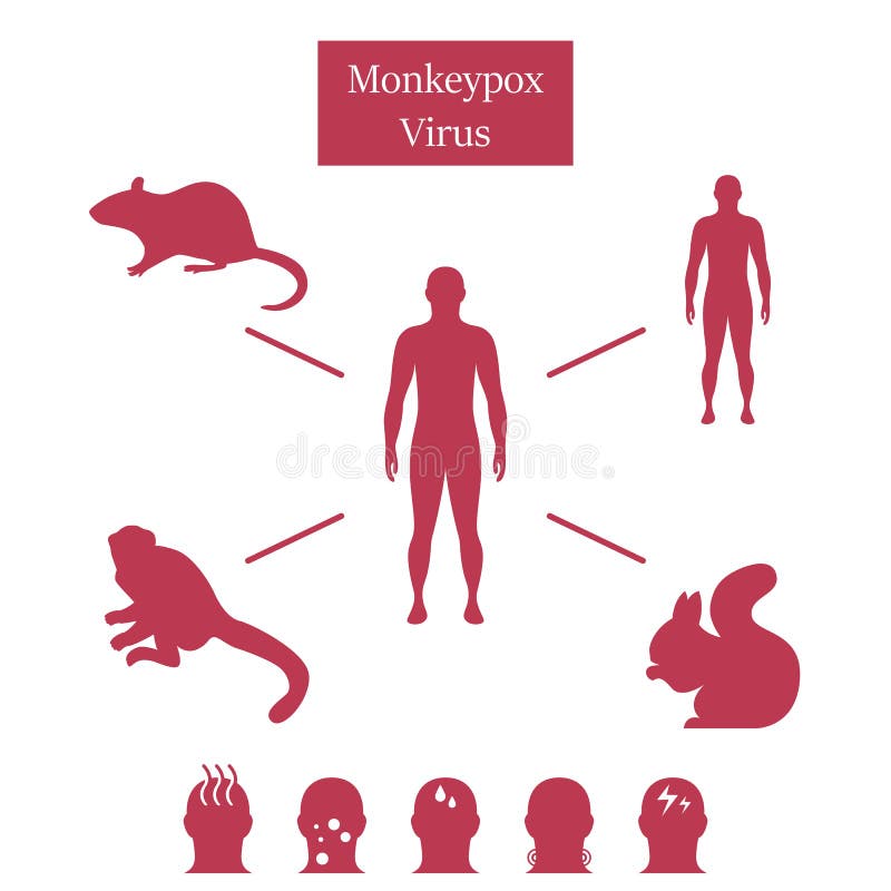 Monkeypox Virus, Hand in Smallpox Ulcers. Smallpox Stock Illustration ...