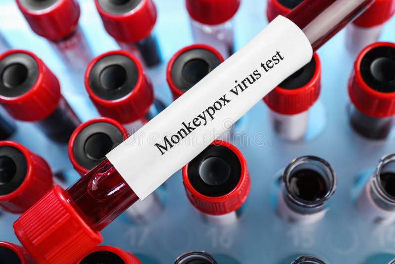 Monkeypox Virus Test. One Sample Tube with Blood on Others, Closeup ...