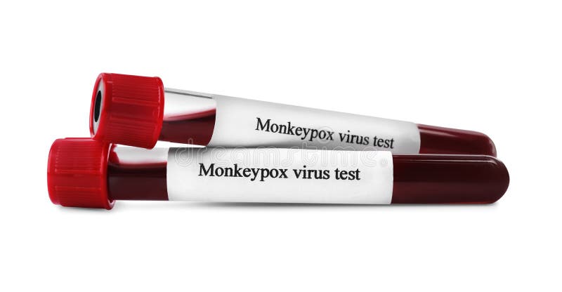 Monkeypox Virus Test. Sample Tubes with Blood on White Background Stock ...
