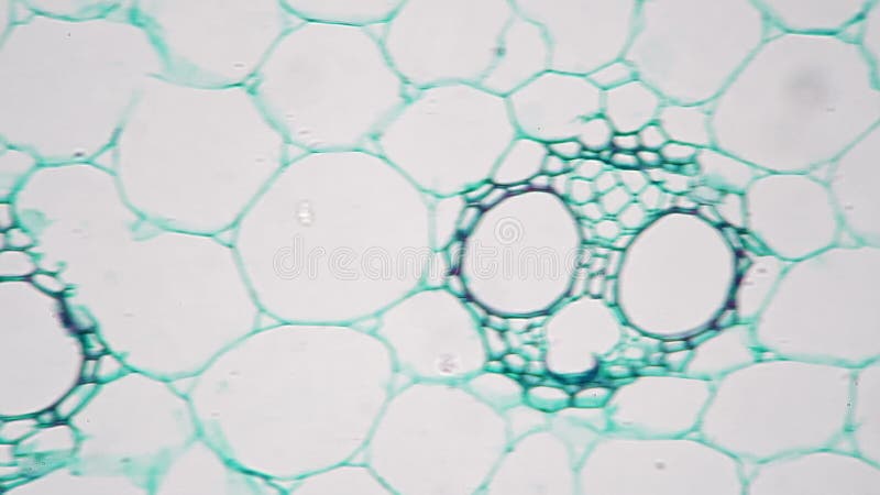 Stem of Monocotyledon Transversal Section Cut Under the Microscope 200x ... Stem of Monocotyledon Transversal Section Cut Under the Microscope 200x ...